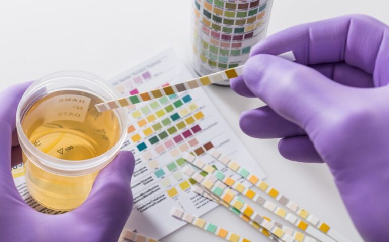 What Can a Dog Urine Test Show? Complete Guide